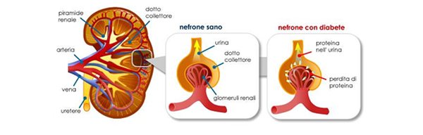 Come il diabete danneggia il rene - Diabete.com