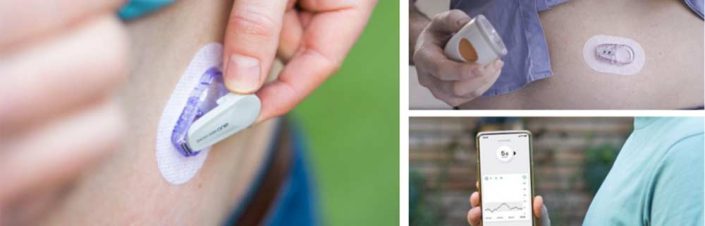 Disponibile in Italia il nuovo sistema DEXCOM ONE CGM per chi è in cura ...